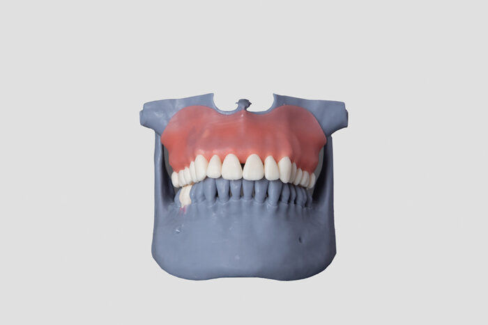 Endo Surgical Model - Angelus Japan